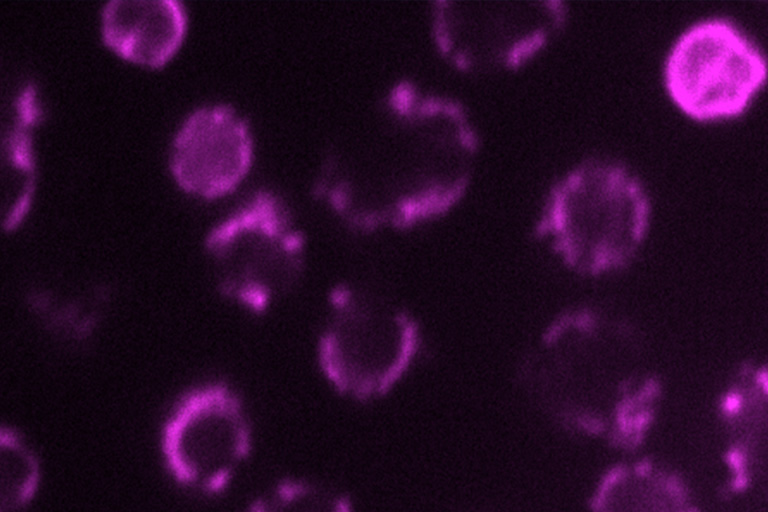 All life copies DNA unambiguously into proteins. Archaea may be the exception. | Letters & Science